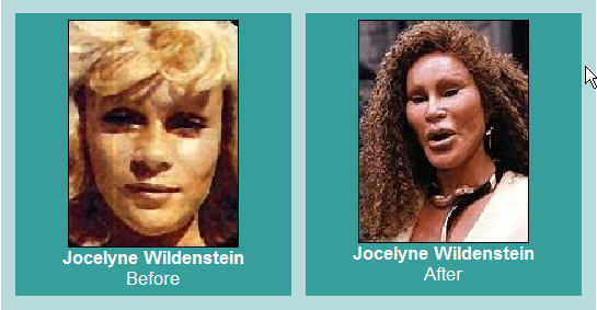The Bride of Wildenstein… -The iPINIONS Journal